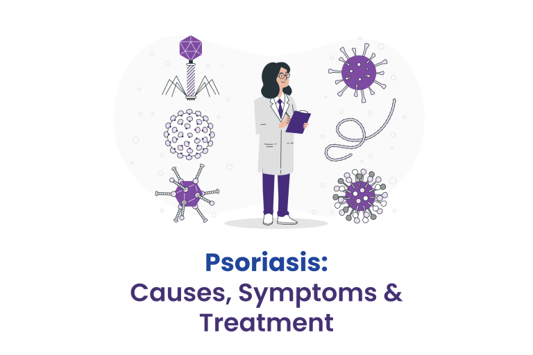Psoriasis: Causes, Symptoms & Treatment - MedIQ Smart Healthcare